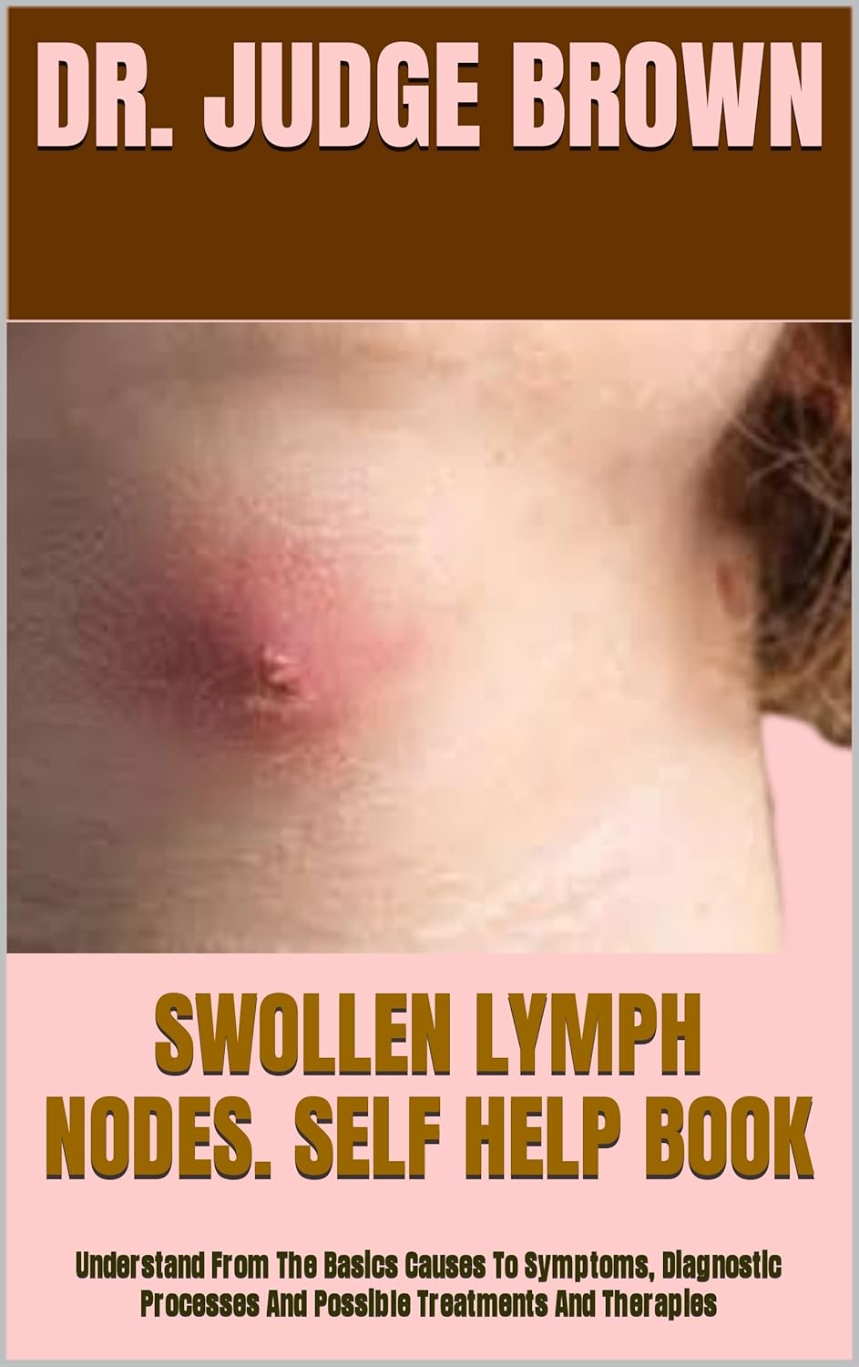 SWOLLEN LYMPH NODES. SELF HELP BOOK : Understand From The Basics Causes ...