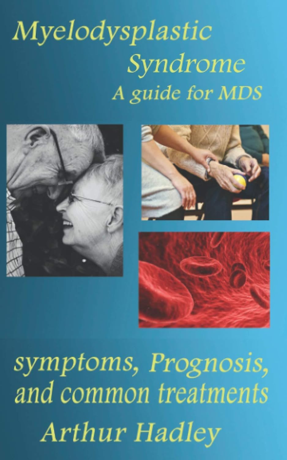 Myelodysplastic Syndrome (MDS): A guide for MDS (symptoms, prognosis ...