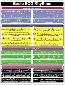 Amazon.com: Basic Ecg Rhythms Chart Metal Signs Cardiology Knowledge ...