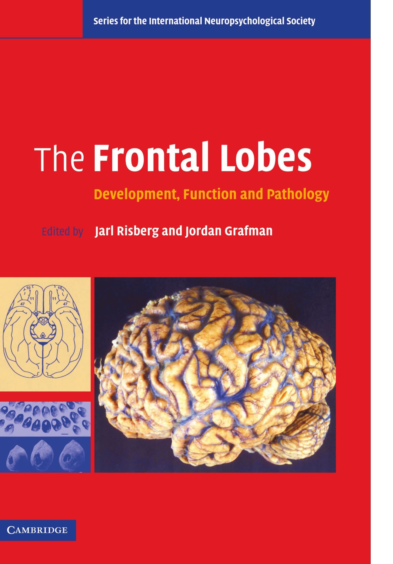 The Frontal Lobes: Development, Function and Pathology (Series for the ...