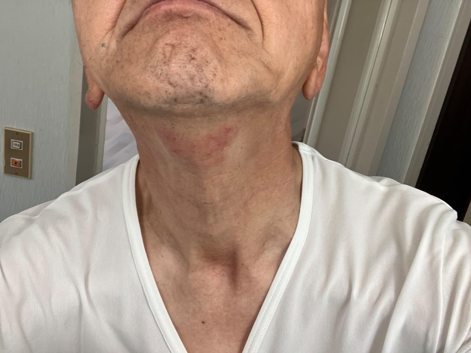 Amazon.co.jp: Snortium Pro - 新しいいびき防止補助具【新】ポータブルいびき防止睡眠補助具、いびき防止補助具、男性と ...