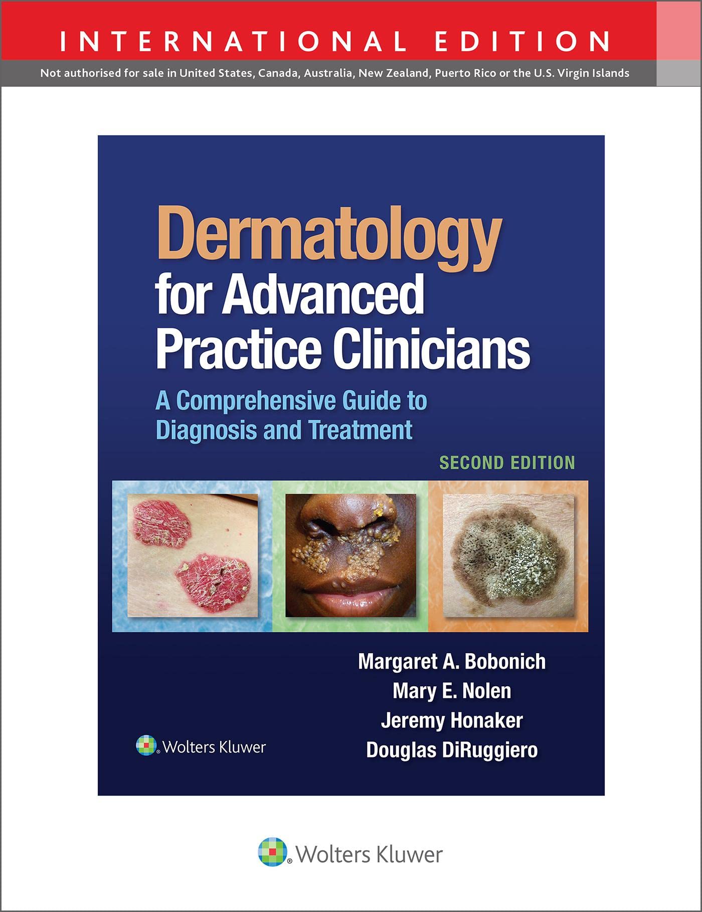 Dermatology for Advanced Practice Clinicians: A Practical Approach to ...