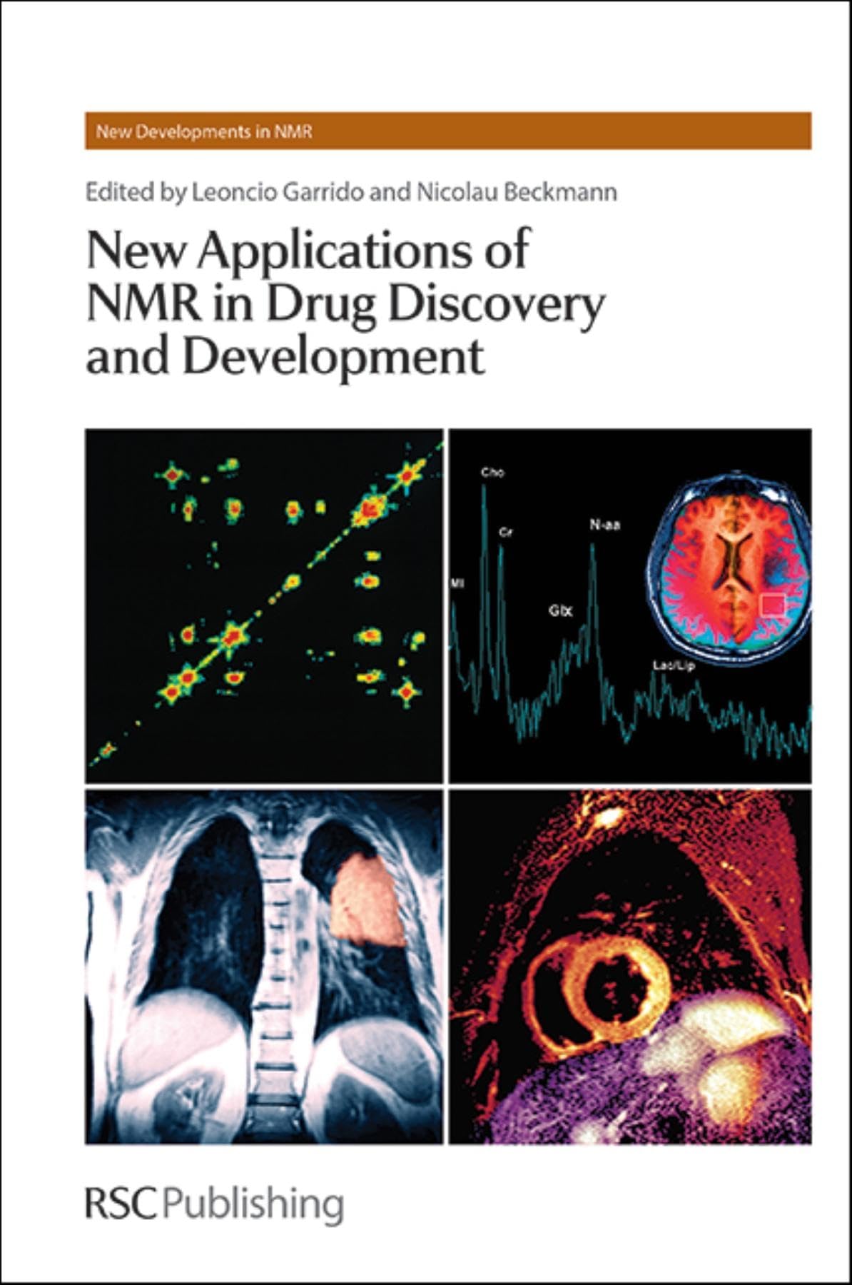 Amazon.com: New Applications of NMR in Drug Discovery and Development ...