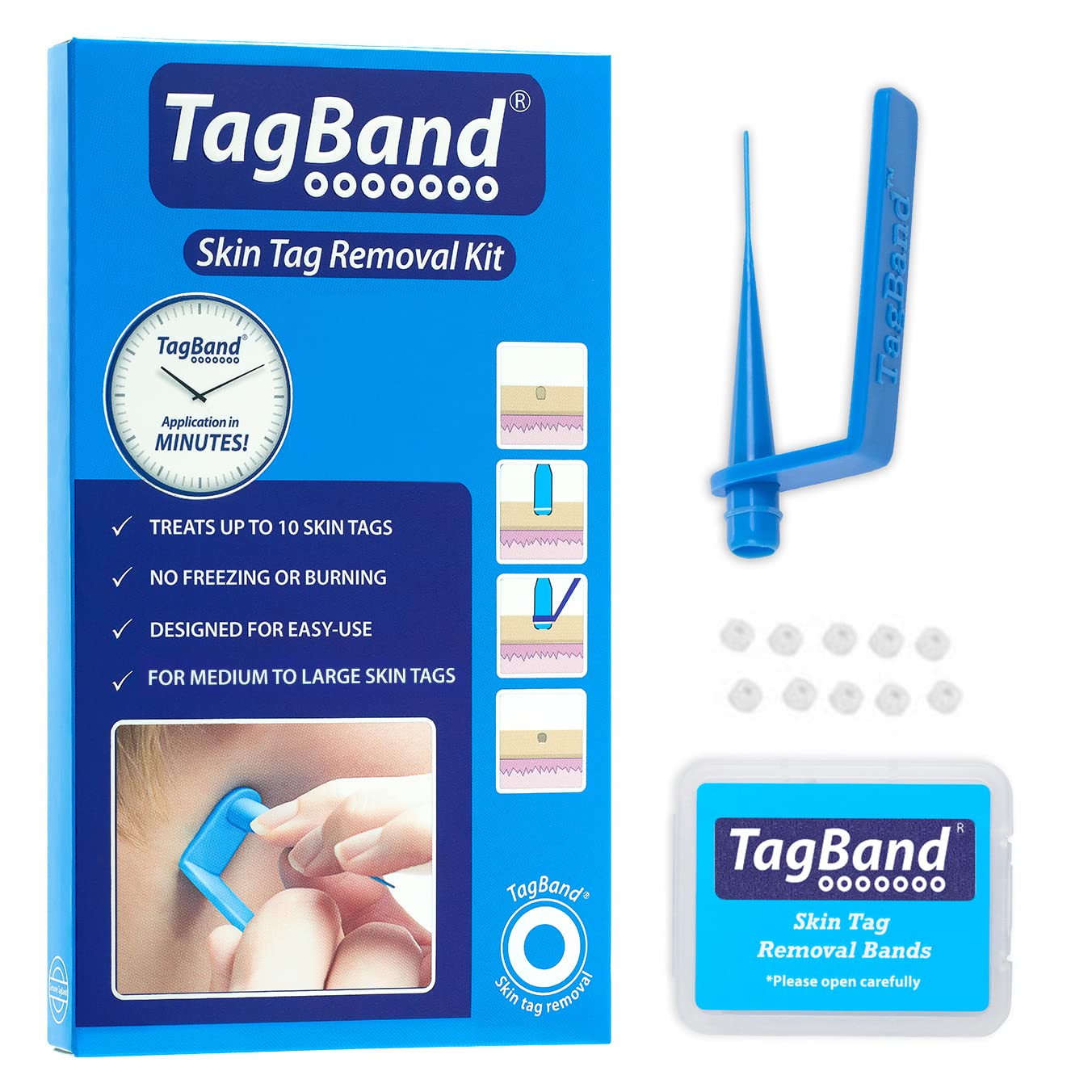 TagBand Skin Tag Removal Device : Amazon.in: Beauty