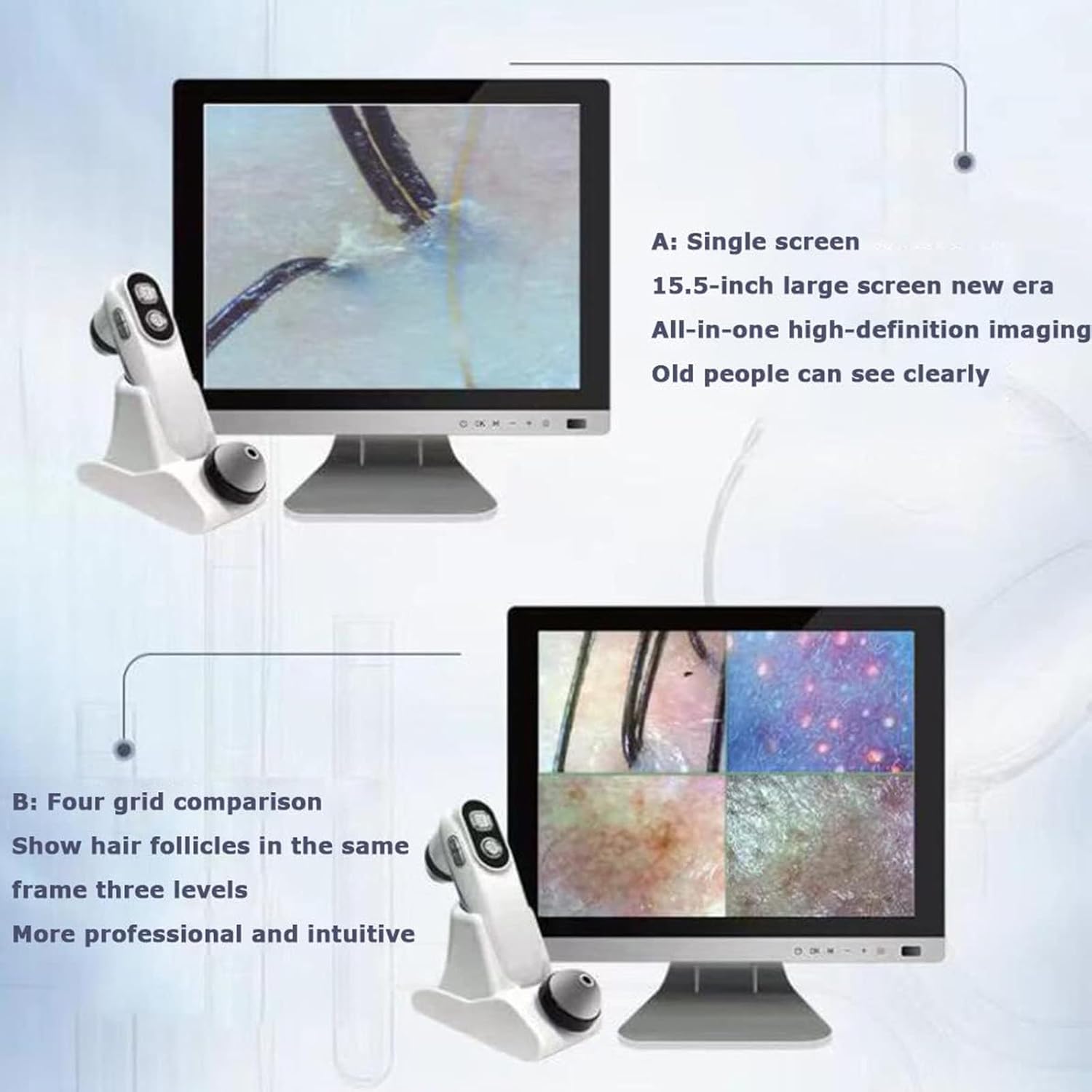 Skin Diagnosis Hair Analyzer,Scalp Hair Follicle Philippines | Ubuy