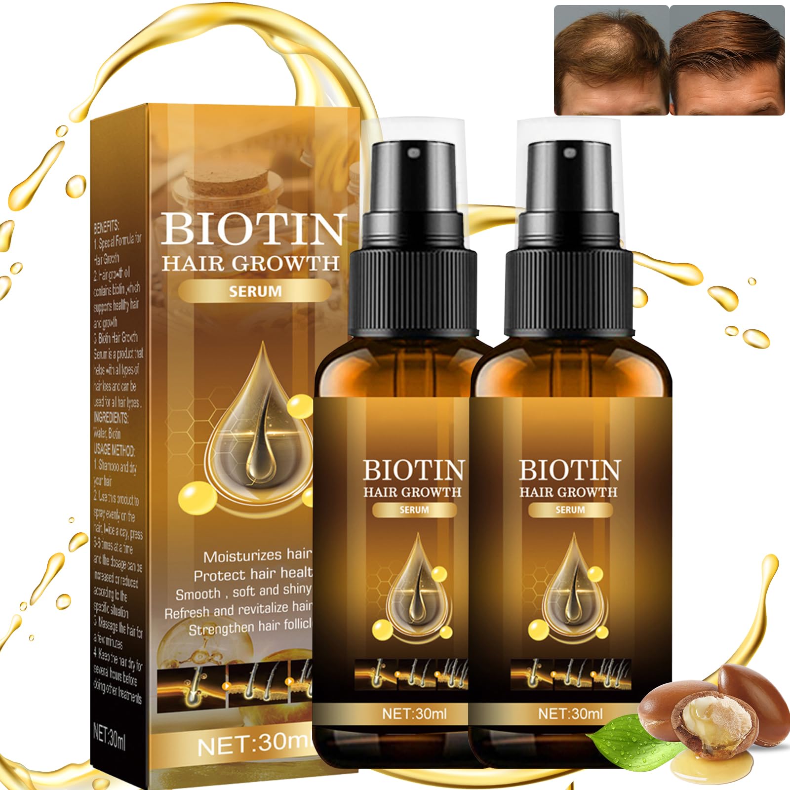 Amazon.com : 2PCS Premium Hair Growth Spray and Thickening Serum for ...