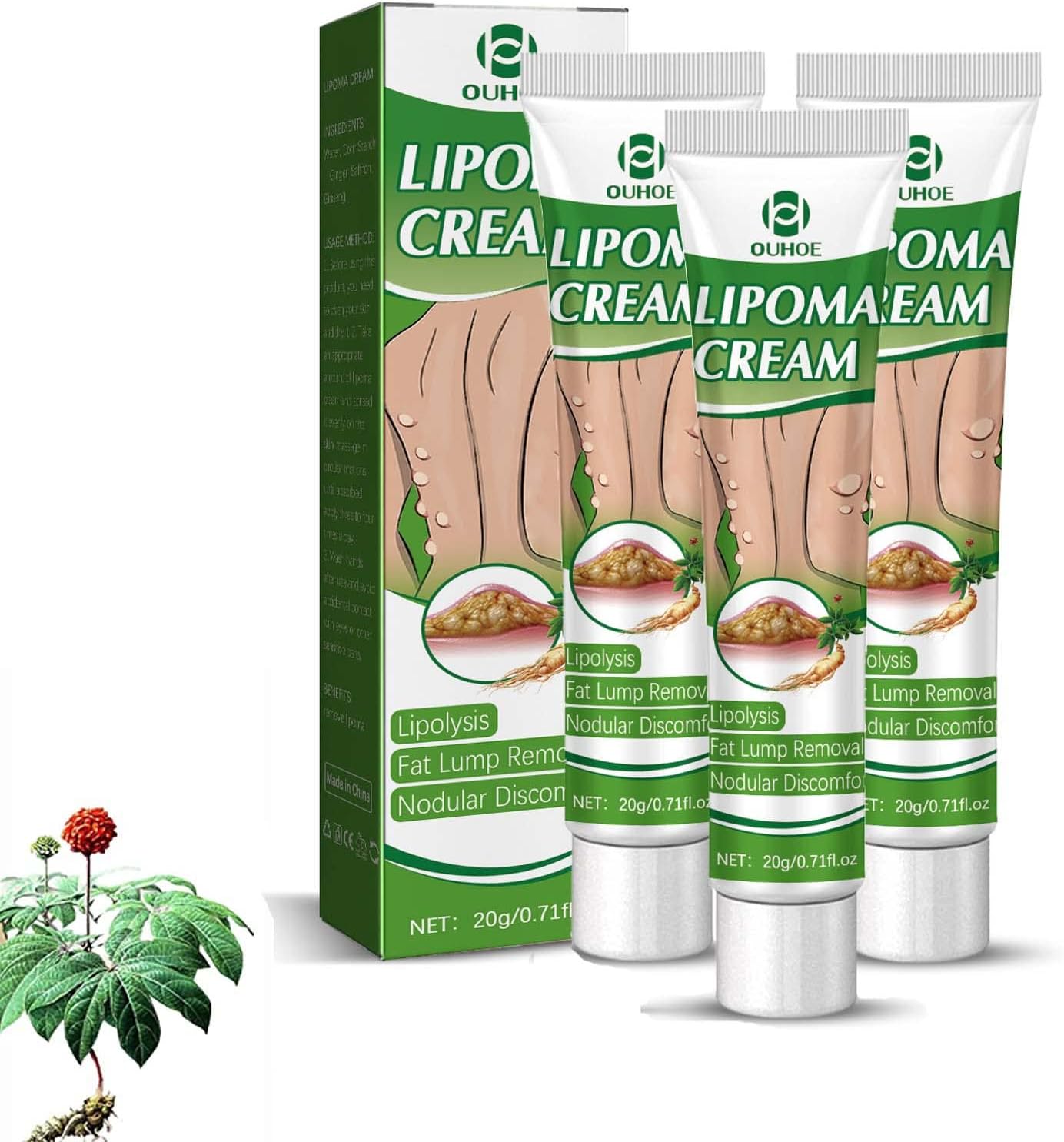 JICINME LumpFree Lipoma Removal Cream, Skin Anti Swelling Ointment ...