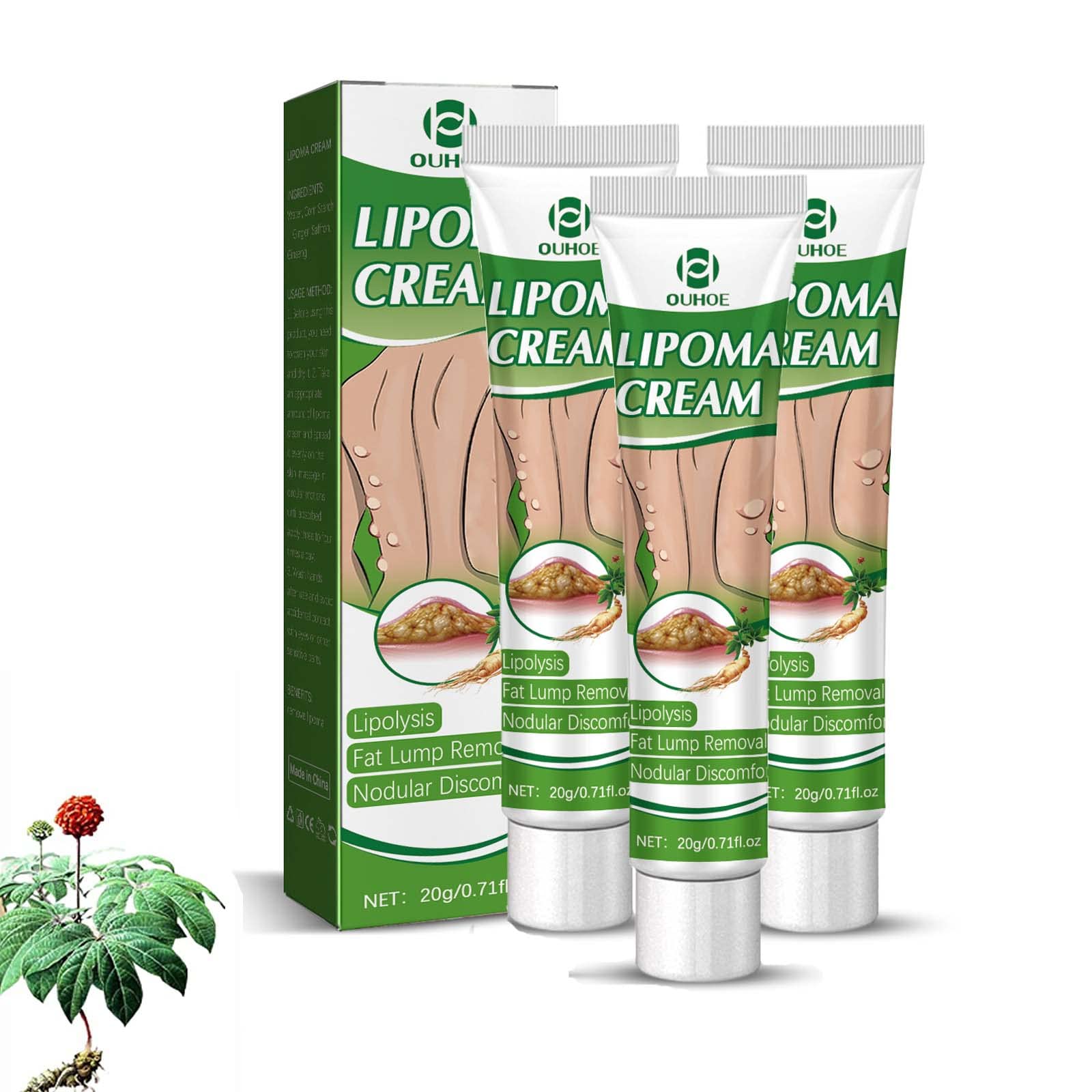Jicinme Lumpfree Lipoma Removal Cream Skin Anti Swelling Ointment ...