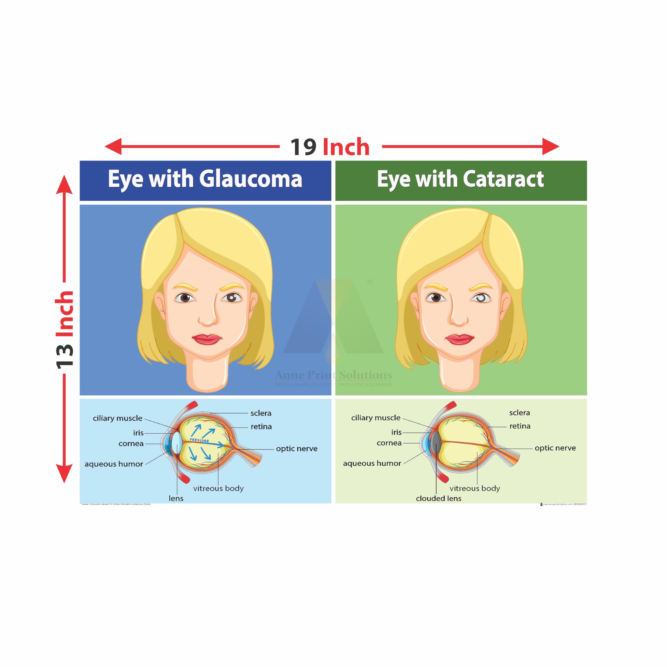 Cataract Quotes Cataracts: Types, Symptoms, Causes And Treatment