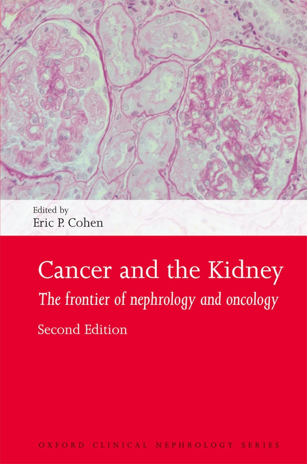 Cancer and the Kidney (Oxford Clinical Nephrology Series ...