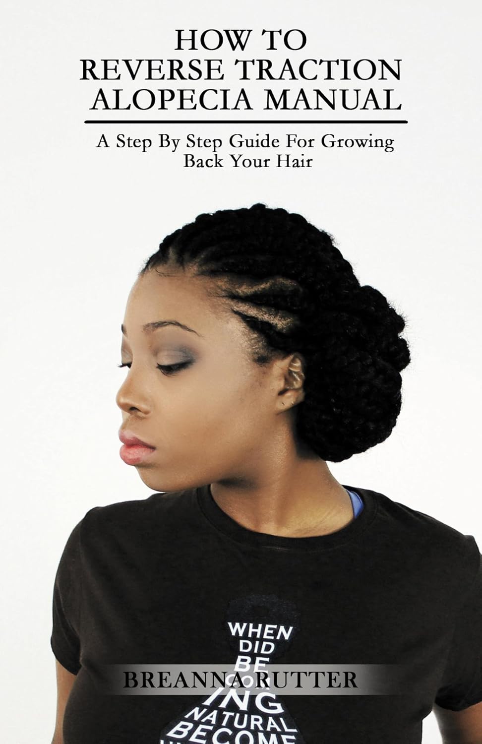 How To Reverse Traction Alopecia Manual: A Step By Step Guide For ...