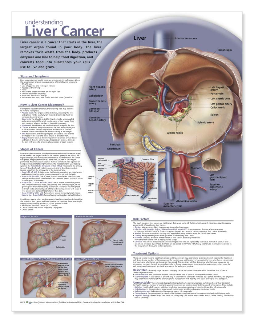 Buy Understanding Liver Cancer Anatomical Chart Book Online at Low ...