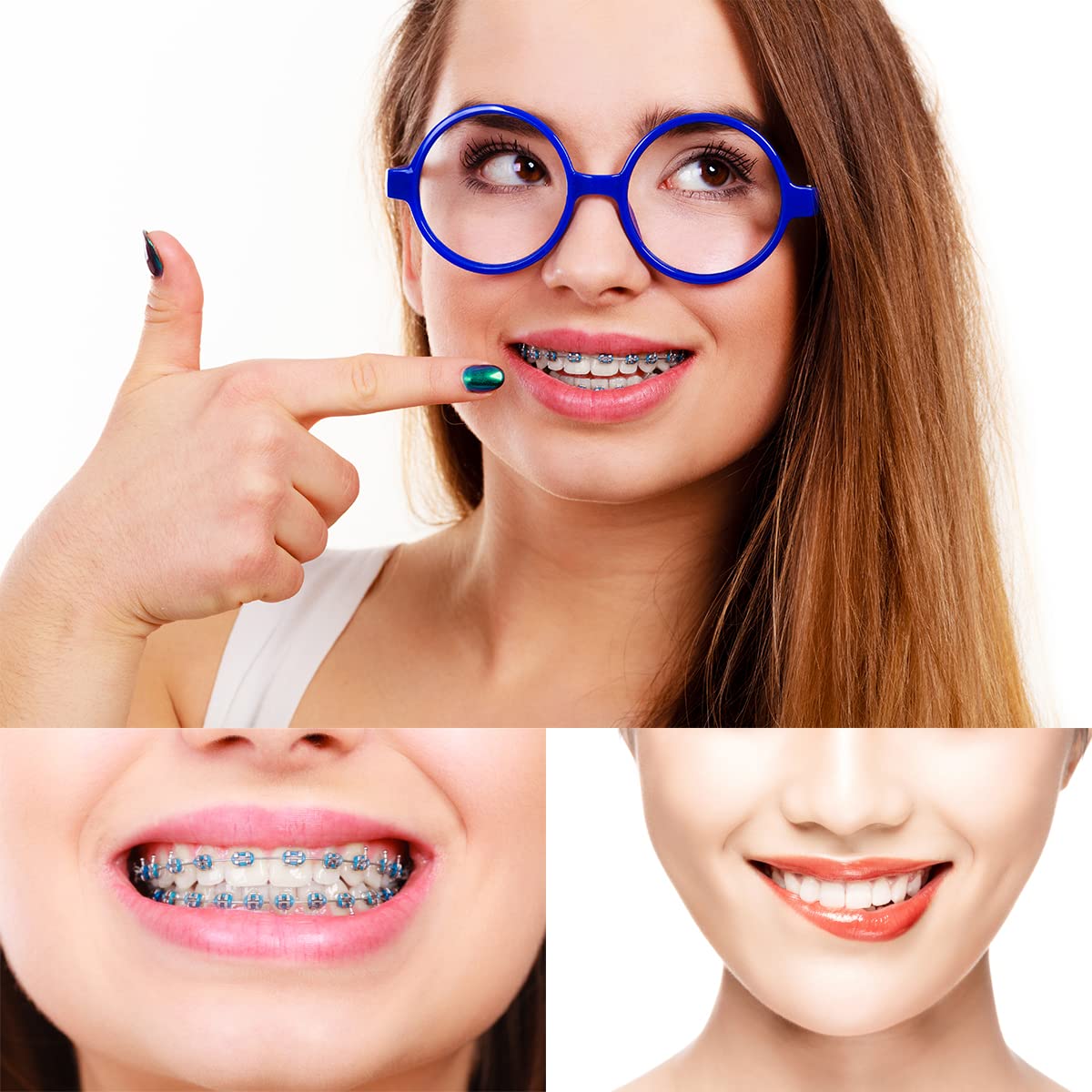 Snapklik.com : Rubber Bands For Braces, 1040 Pcs Color Orthodontic ...