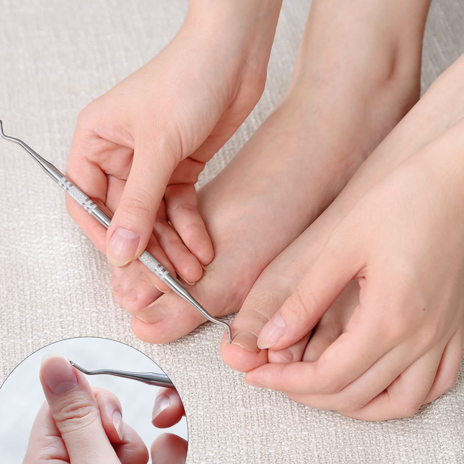 Snapklik.com : (30+3) Pack Ingrown Toenail Correction Treatment Kit ...