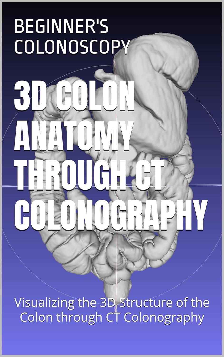 3D Colon Anatomy through CT Colonography: Visualizing the 3D Structure ...