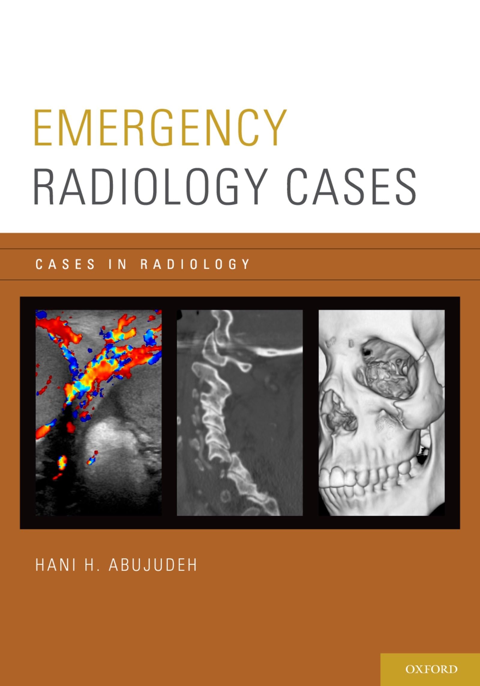 Emergency Radiology Cases (Cases in Radiology): 9780199941179: Medicine ...