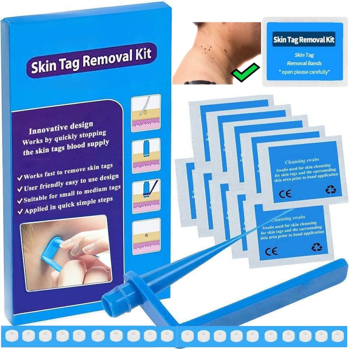 Skin Tag Remover Kit (2-4mm) CONR Micro Painless DIY at Home with ...