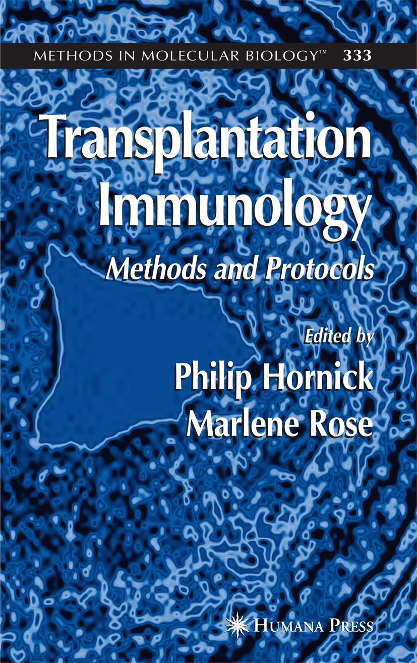 Transplantation Immunology: Methods and Protocols (Volume 333): Hornick ...