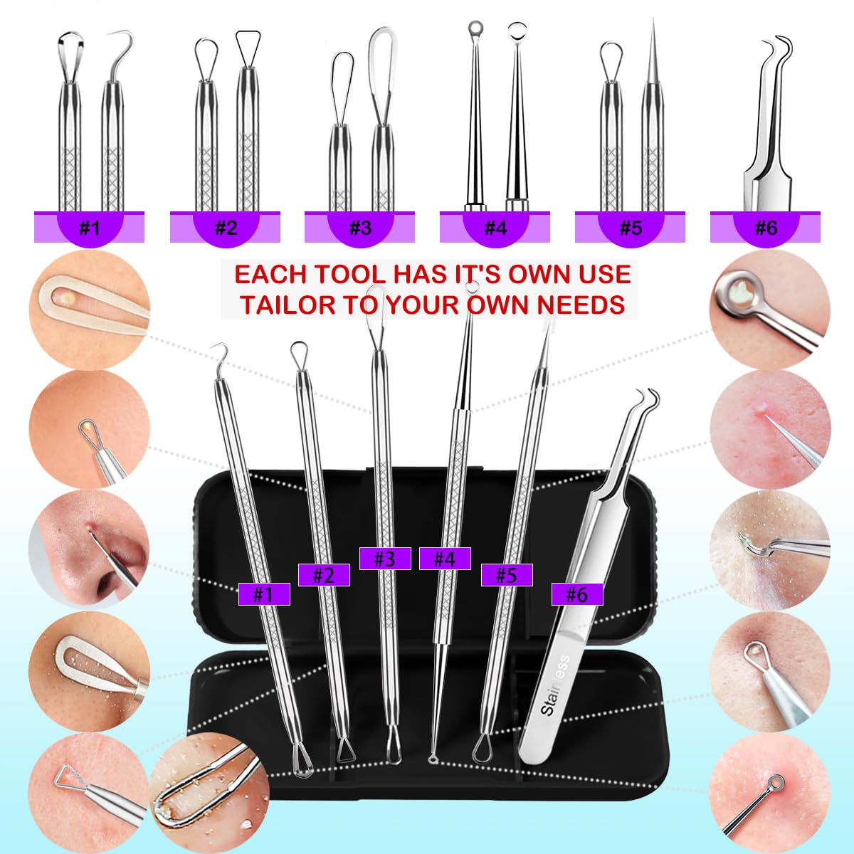 Blackhead Removal Tool Name