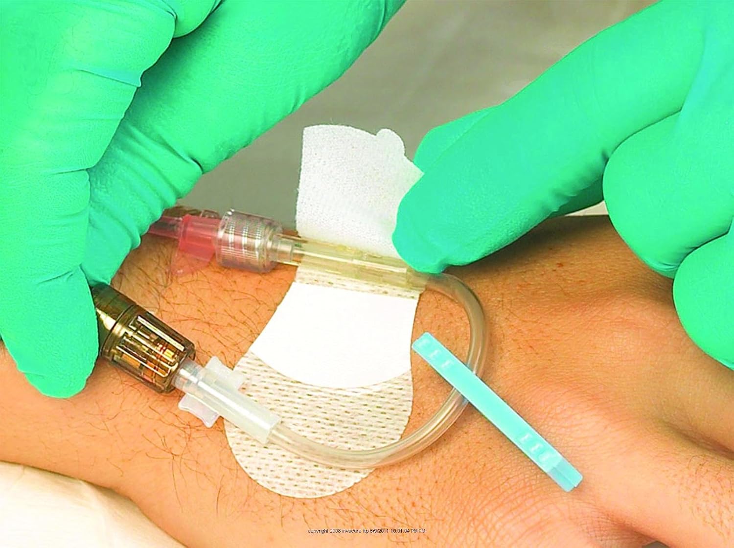 Amazon.com: Grip-Lok Individually Packaged Medium Universal/1/8” - 5/16 ...