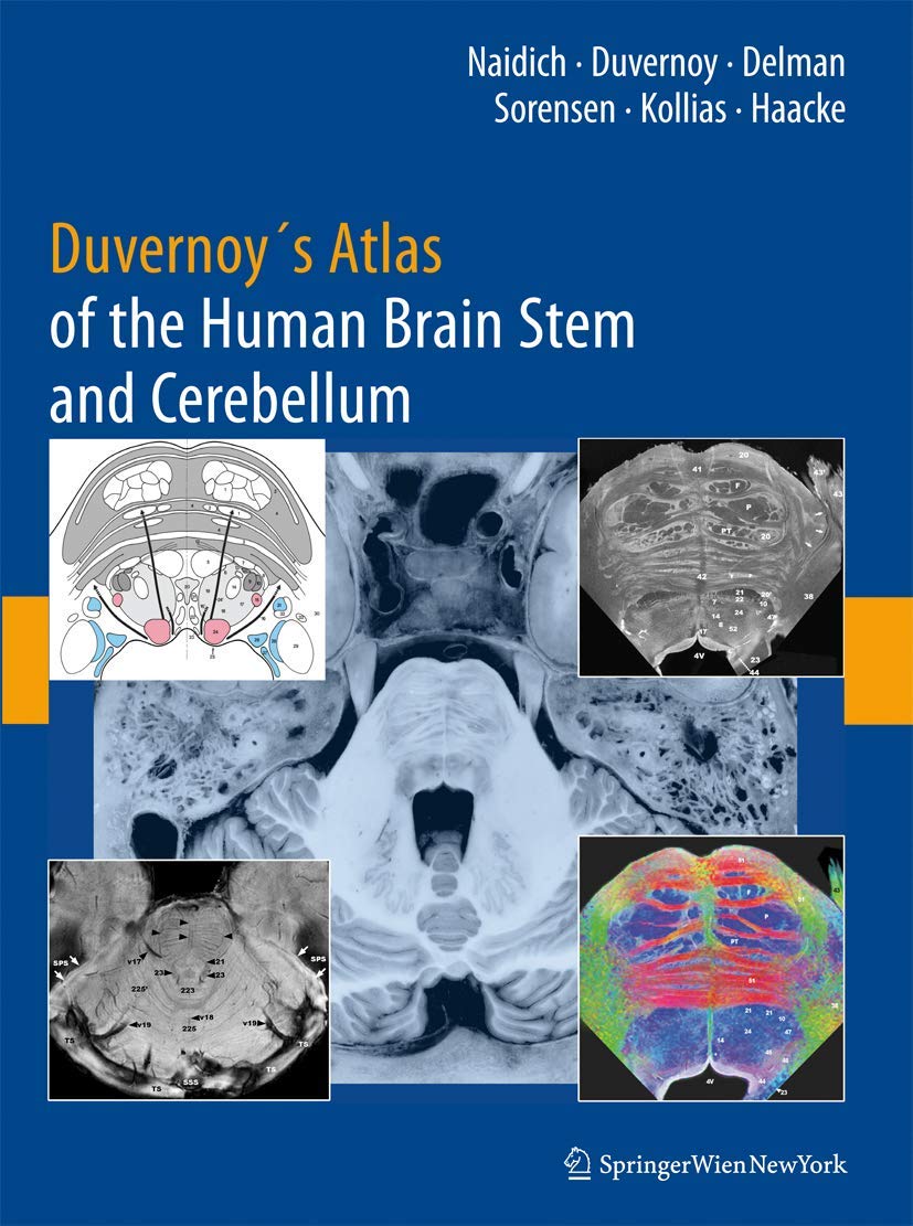 Buy Duvernoy's Atlas of the Human Brain Stem and Cerebellum: High-field ...