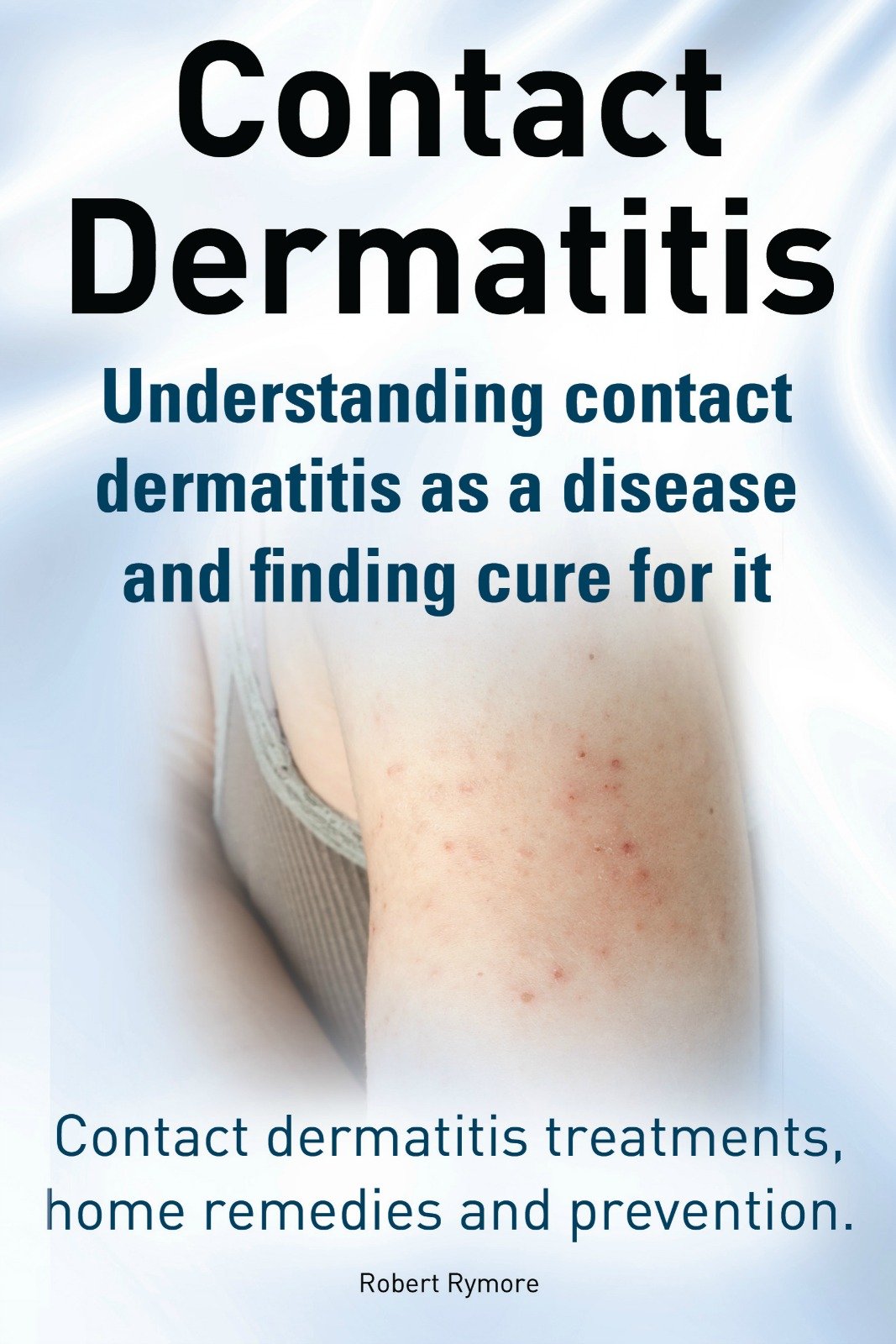 Buy Contact Dermatitis. Contact dermatitis s, prevention and home ...