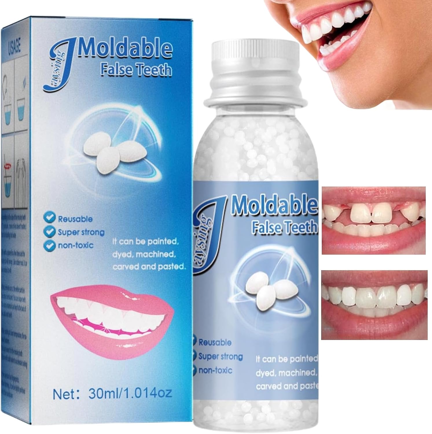 Tooth Repair Kit,Temporary Tooth Filling Repair Beads,Tooth Repair ...