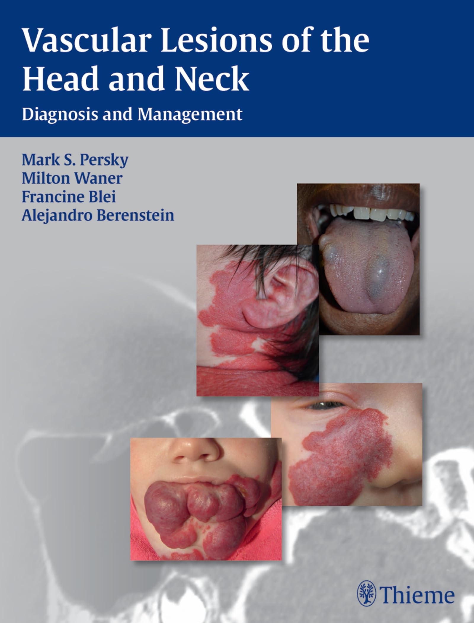 Snapklik.com : Vascular Lesions Of The Head And Neck: Diagnosis And ...