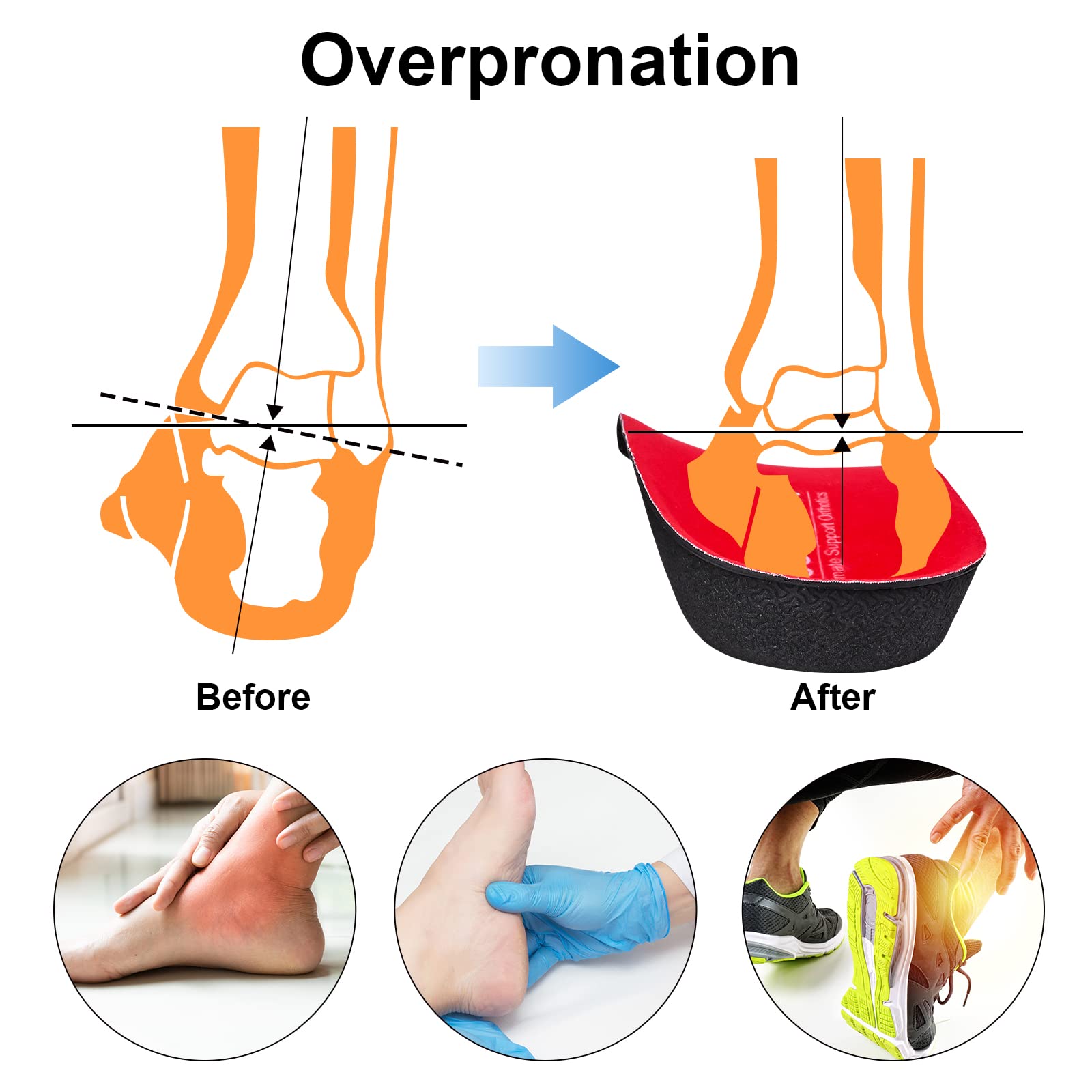 Snapklik.com : FeetTouch 3/4 High Arch Rigid Orthotics For Plantar ...