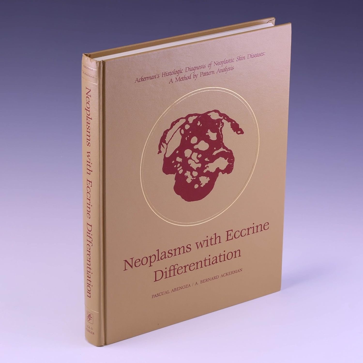 Amazon | Neoplasms With Eccrine Differentiation: Ackerman's Histologic ...