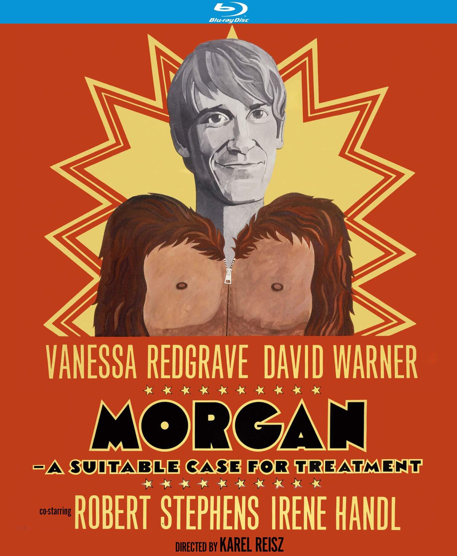 Amazon.com: Morgan, A Suitable Case for Treatment [Blu-ray] : Vanessa ...