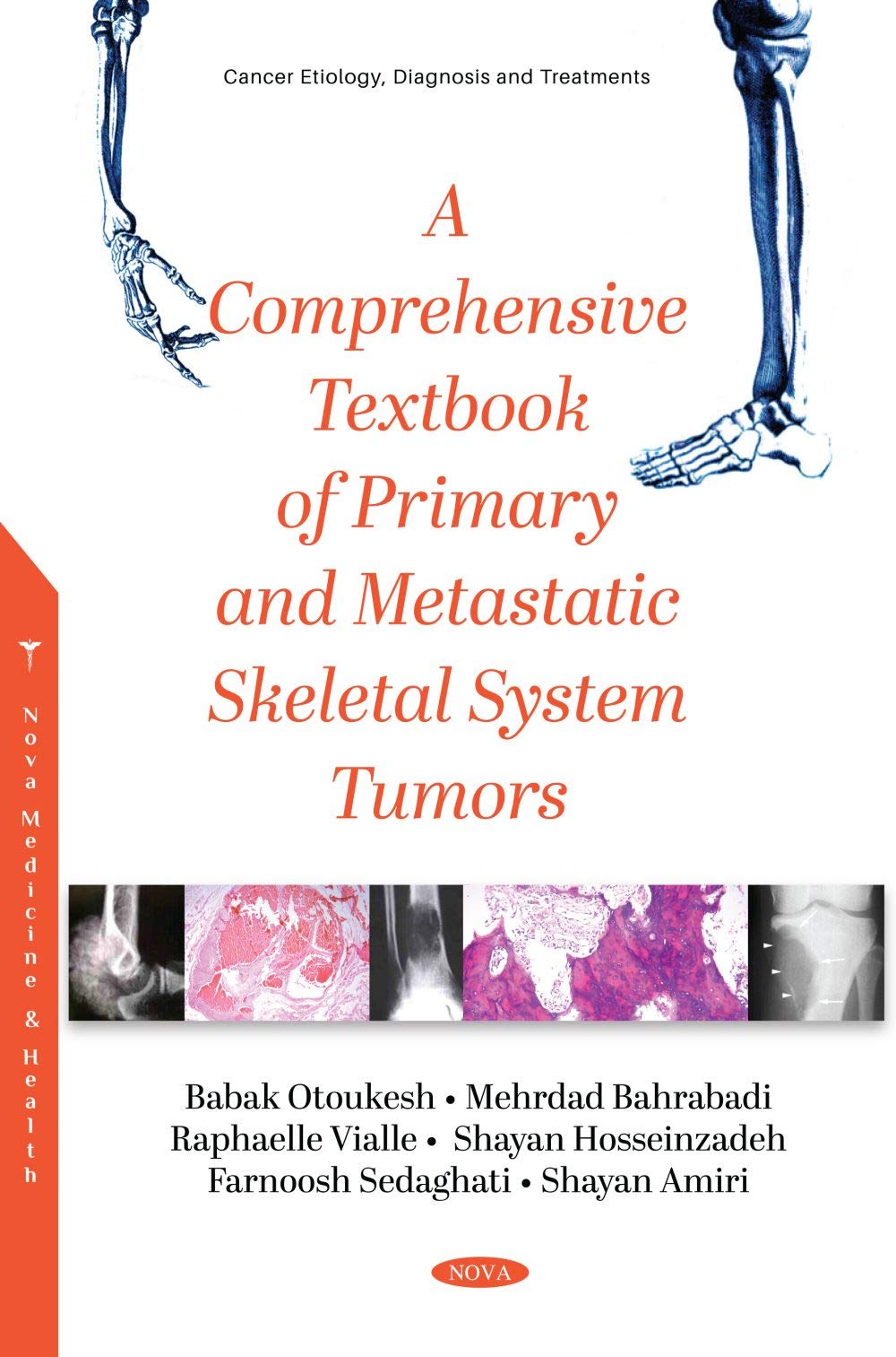 A Comprehensive Textbook of Primary and Metastatic Tumors of the ...