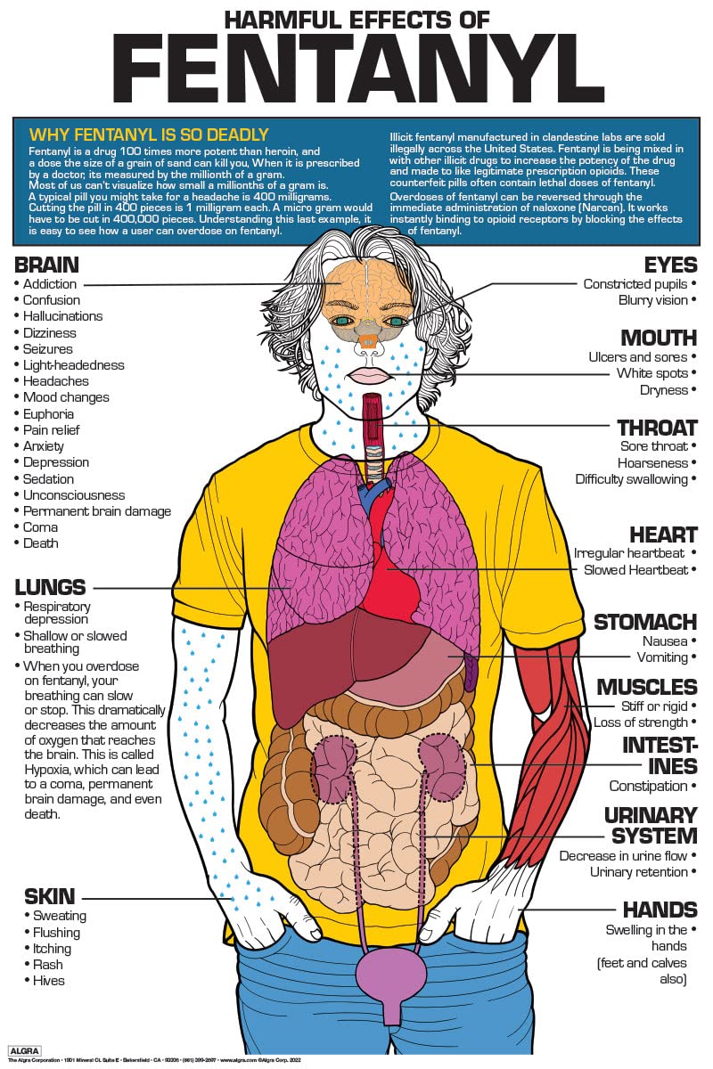 Algra Corporation Harmful effects of Fentanyl 24 x 36 Laminated Poster ...