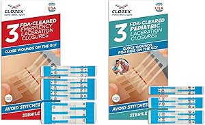 Amazon.com: Clozex Emergency & Pediatric Laceration Closure Bundle, FSA ...