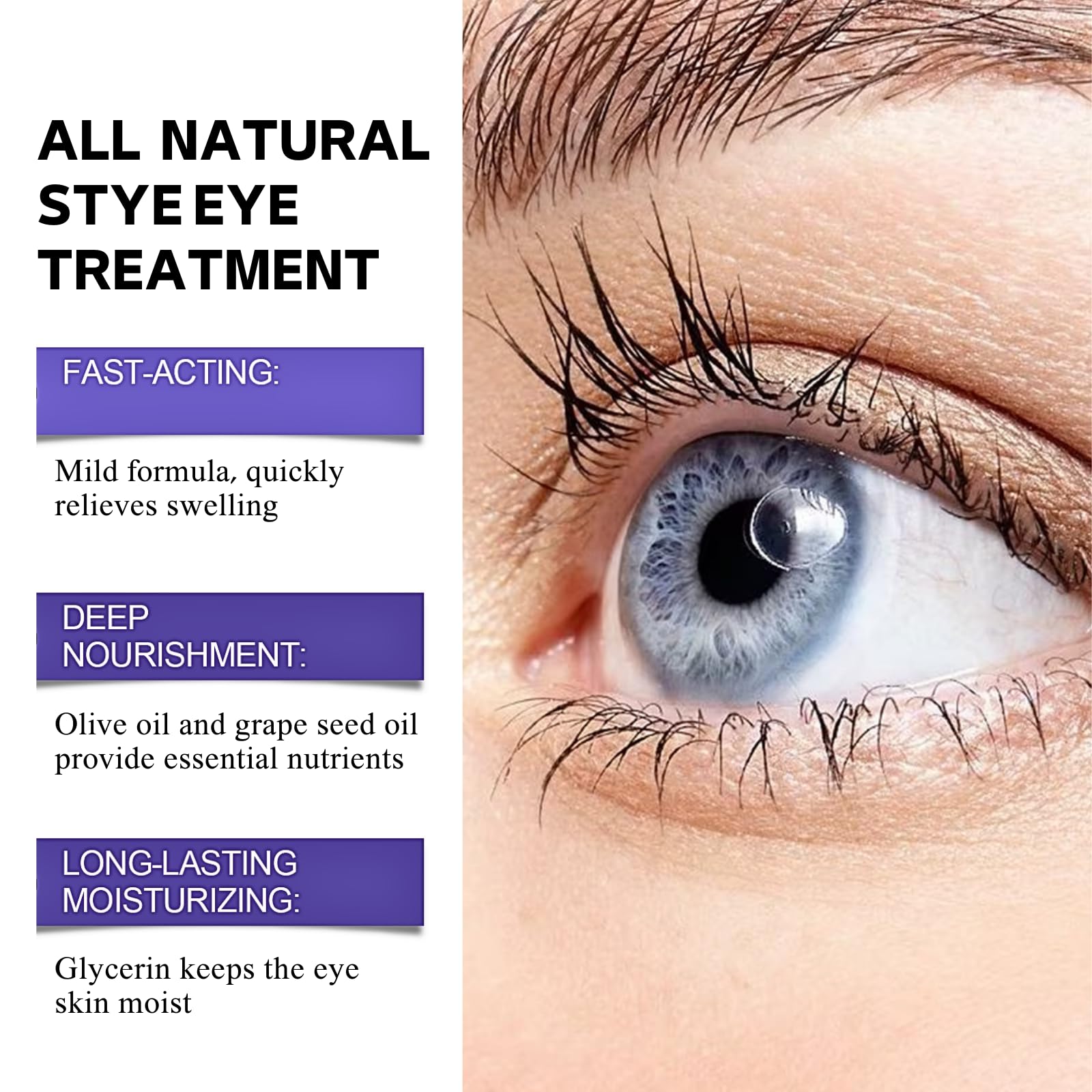 Stye Eye Treatment, Under Eye Serum for Styes Chalazion Blepharitis ...