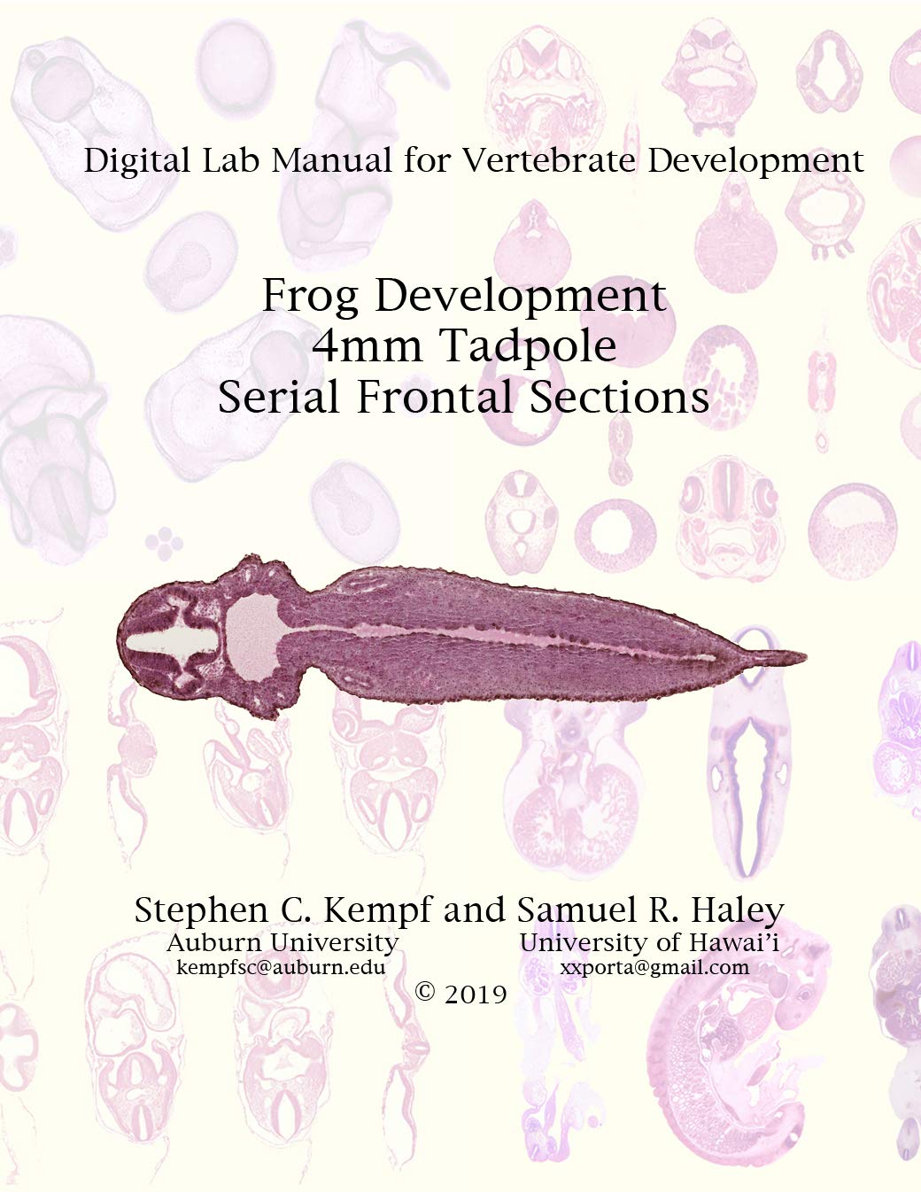 Amazon.com: 4mm Frog Tadpole Serial Frontal Sections: Digital Lab ...