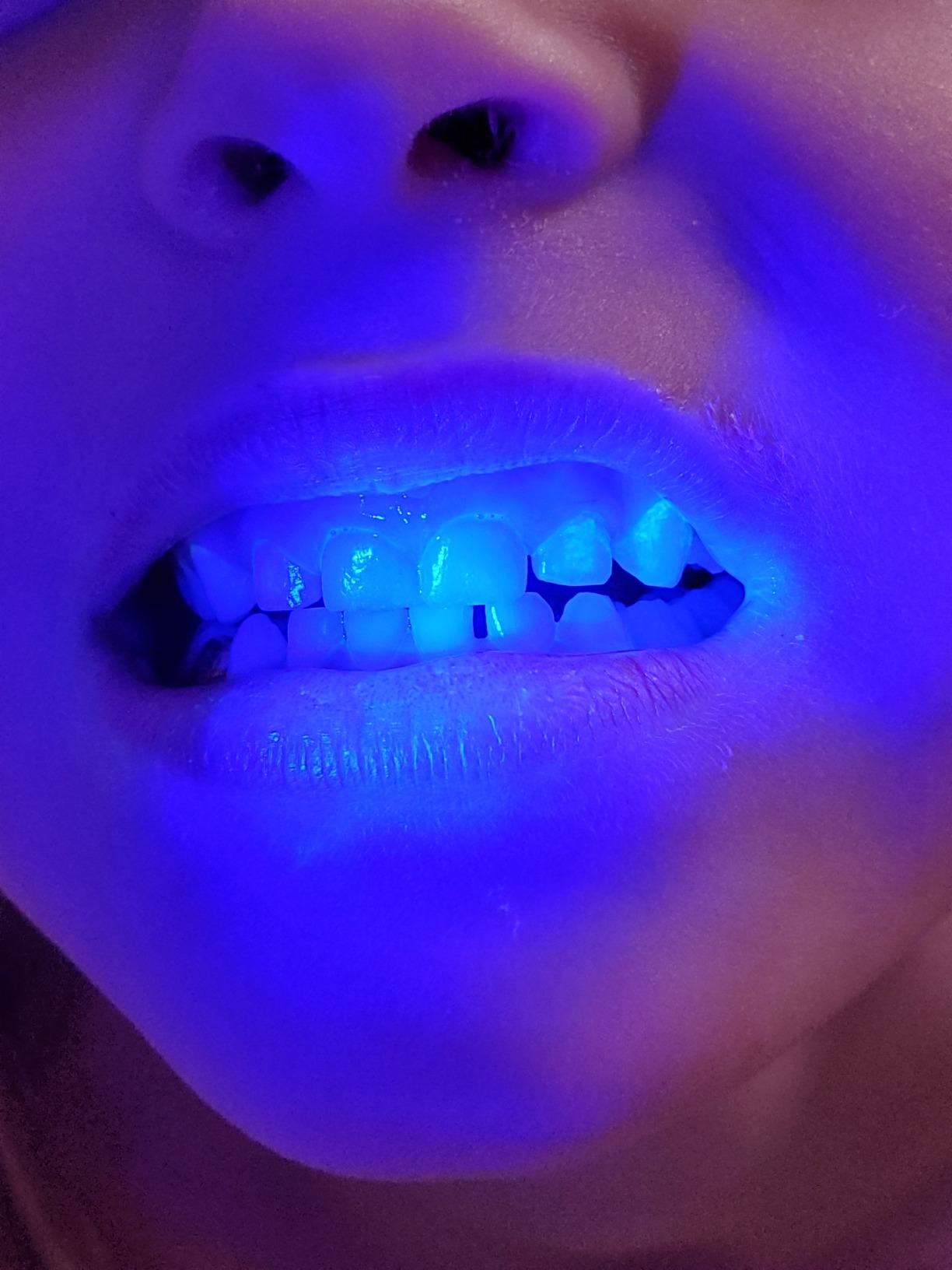 Amazon.com: Piksters Plaque Glo - Plaque Disclosing Toothpaste and ...