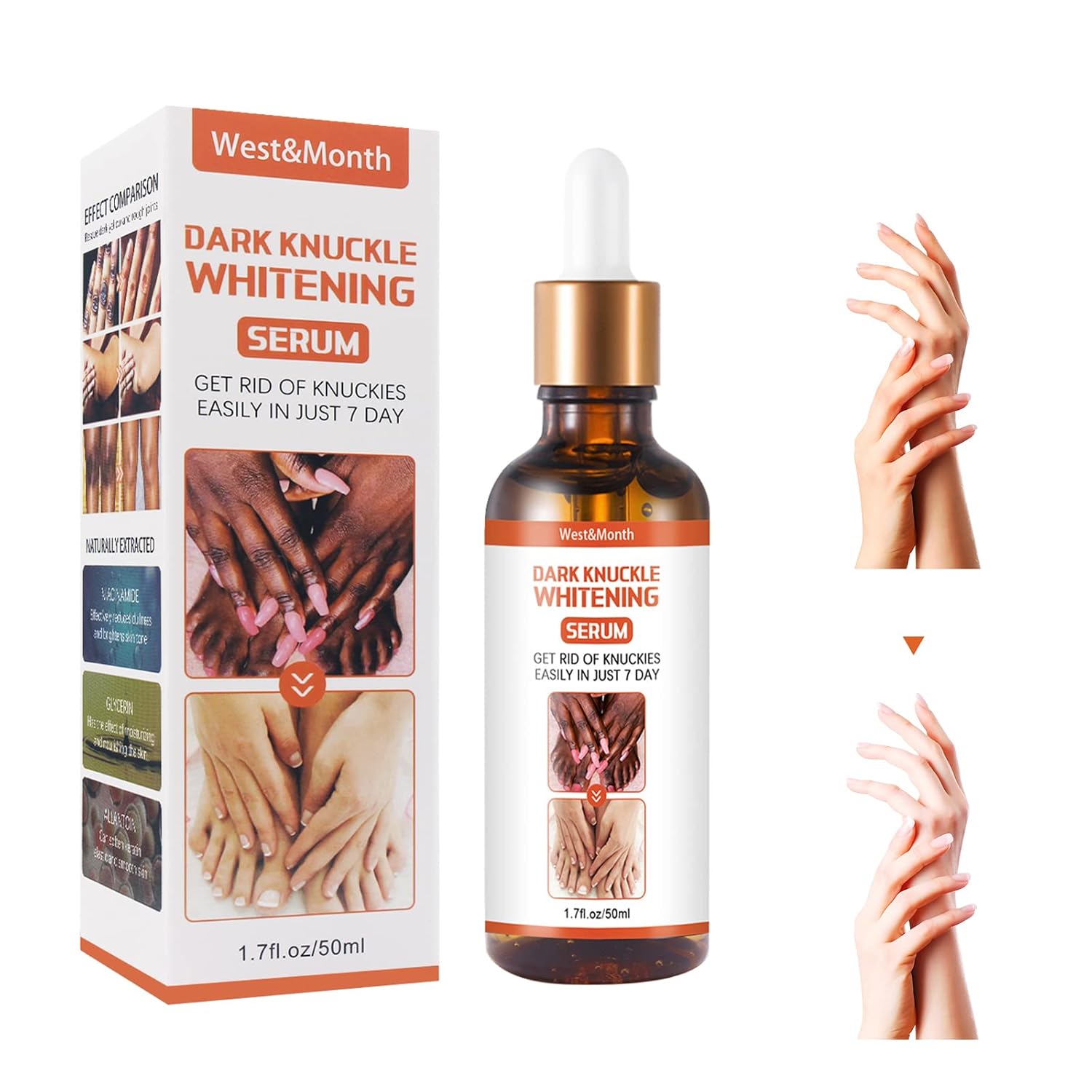 Fengyang Hautaufhellendes Serum, Dunkle Knuckle Whitening Cream, Dark ...