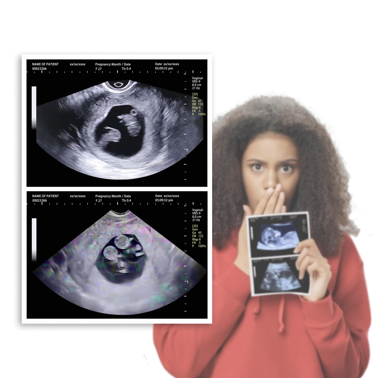 Amazon.com: Personalized Prank Pregnancy Ultrasound Photos Fake ...