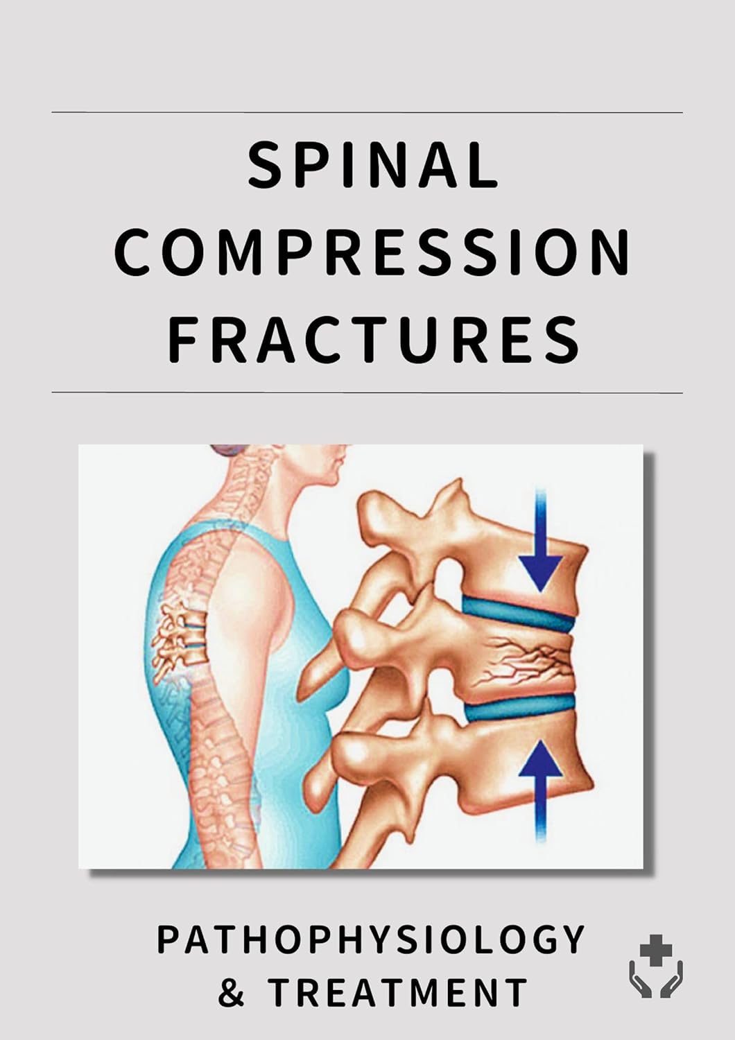 Spinal Compression Fractures: Pathophysiology ＆ Treatment eBook ...