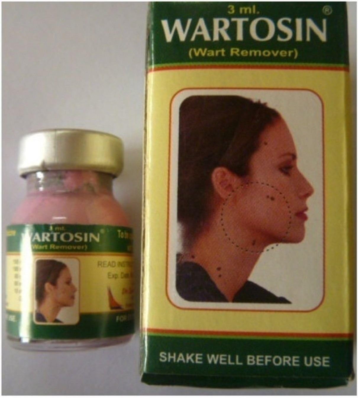 Wartosin (3 ml) Skin Tags & Wart Removal WARTOSIN Herbal Wart Remover ...