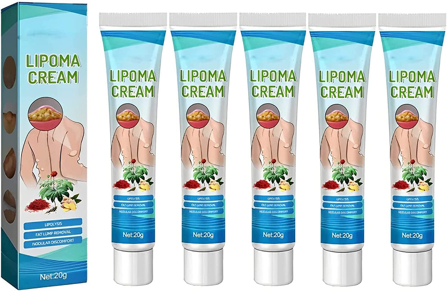 Buy LumpFree Lipoma Removal Cream, Natural al Lipoma Lumps Removal ...