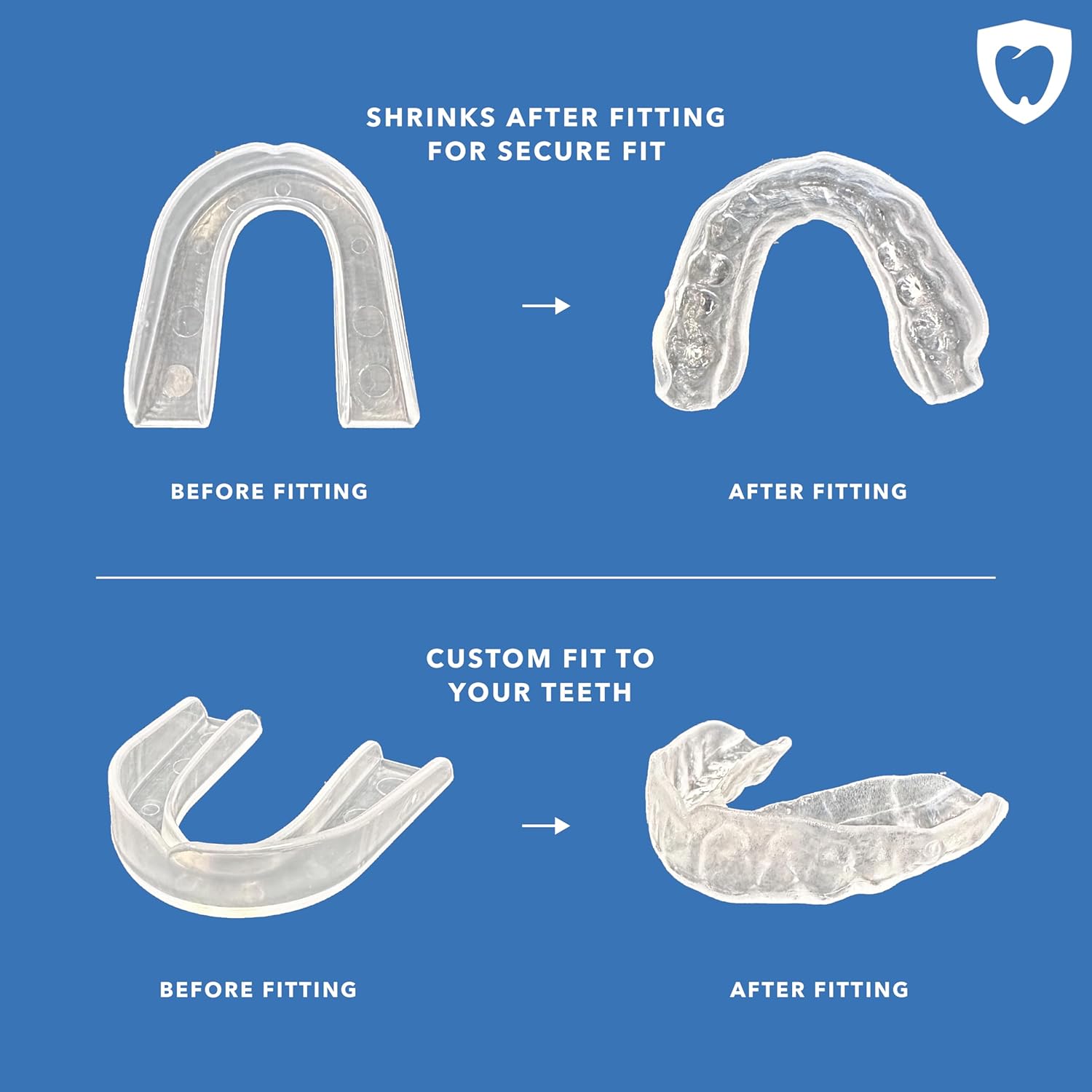 Custom Fit Night Guard for Teeth Grinding - Nepal | Ubuy