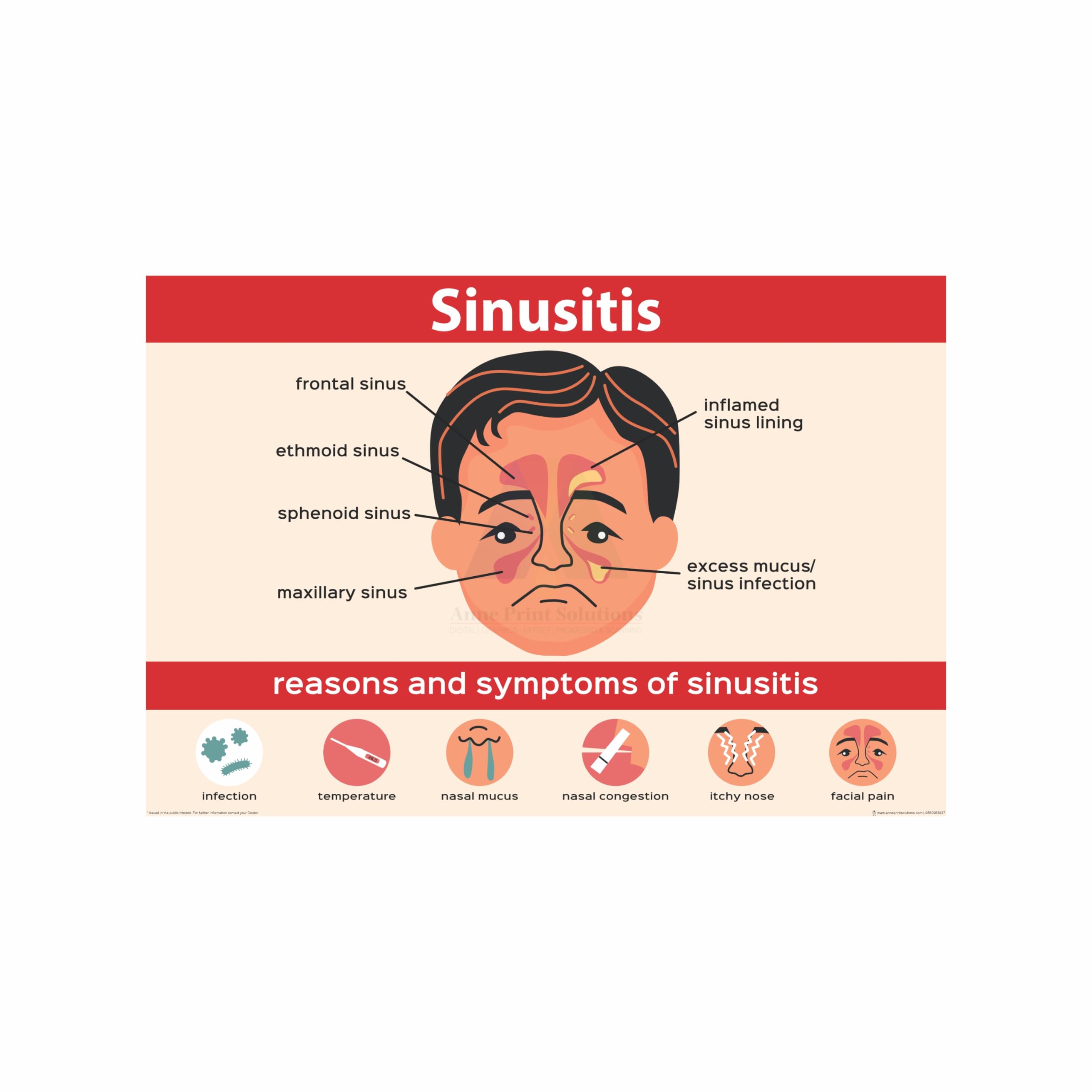 Anne Print Solutions® sinusitis chart Posters Without Frame Hospital ...