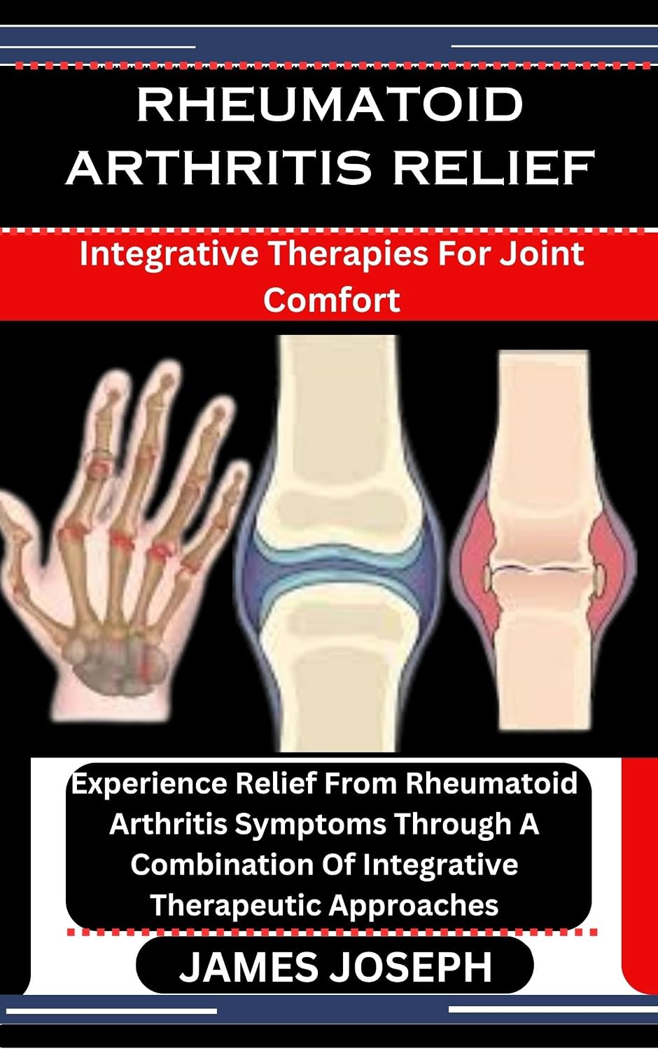 RHEUMATOID ARTHRITIS RELIEF : Integrative Therapies For Joint Comfort ...