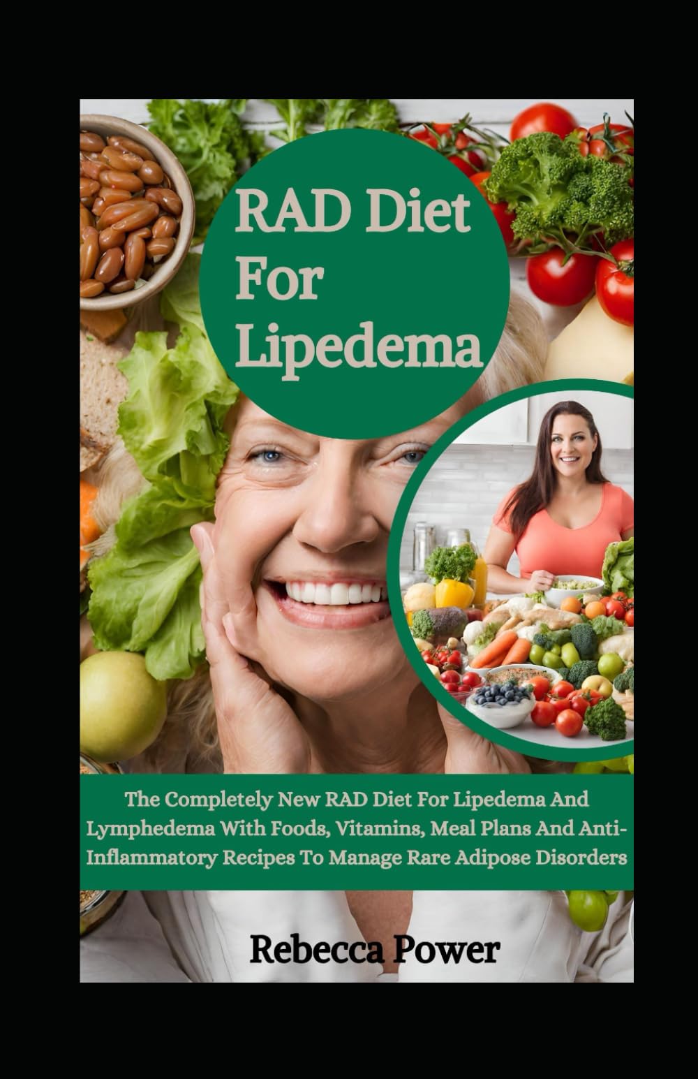 RAD Diet For Lipedema: The Completely New RAD Diet For Lipedema And ...