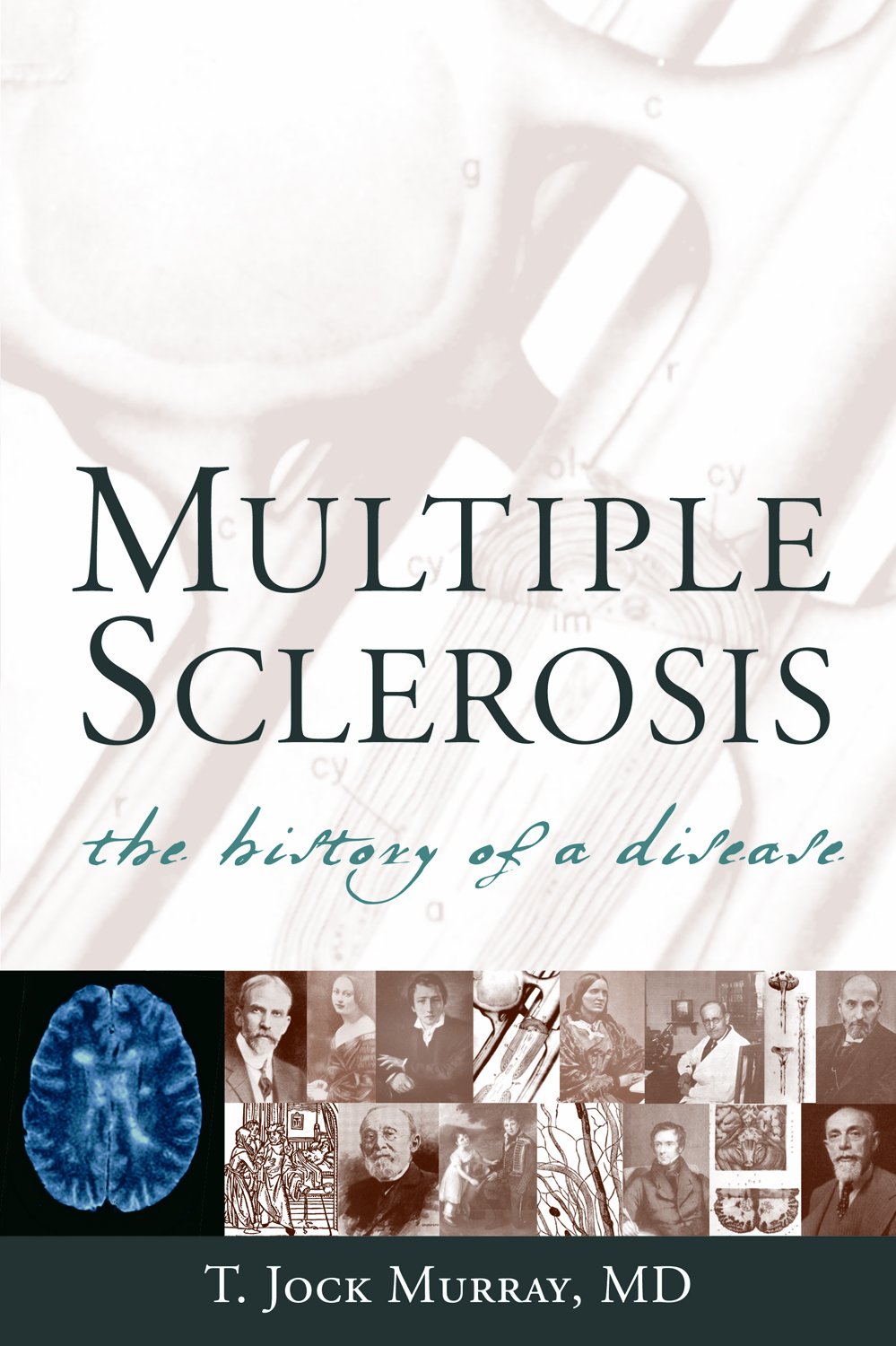 Multiple Sclerosis: The History of a Disease: Murray MD, T. Jock ...