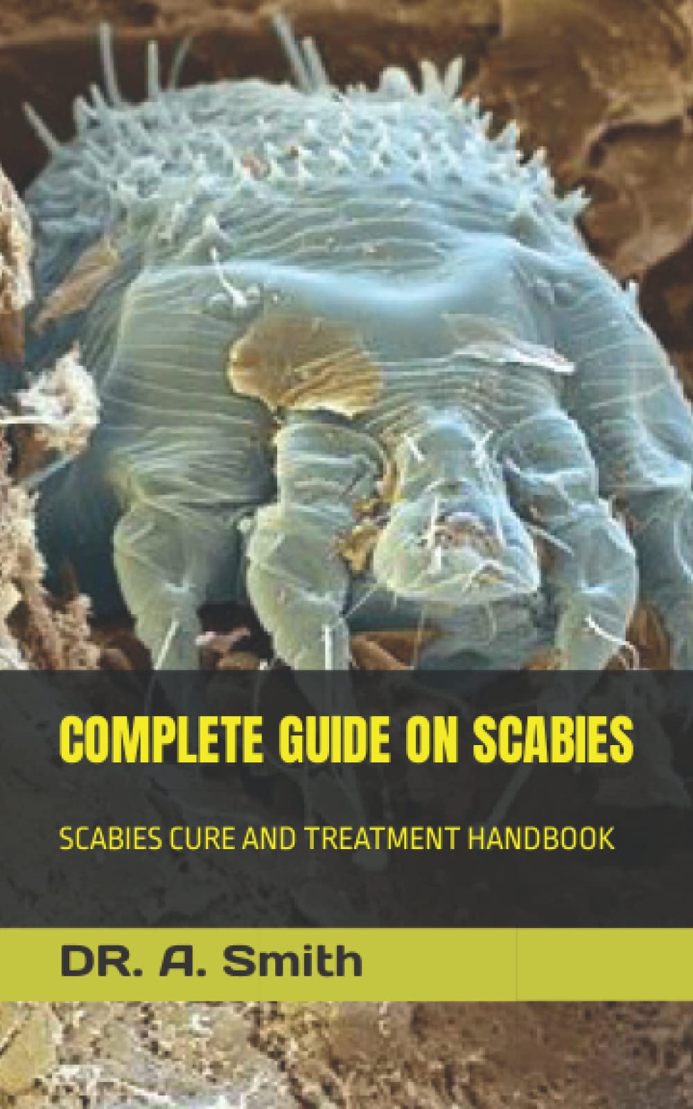 Buy COMPLETE GUIDE ON SCABIES: SCABIES CURE AND HANDBOOK Online at ...