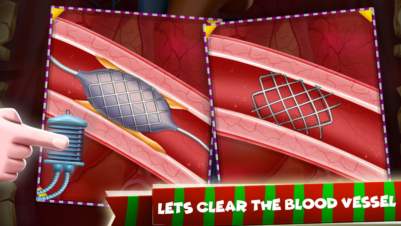 Crazy Heart Surgery Simulator - Doctor Game - App on Amazon Appstore