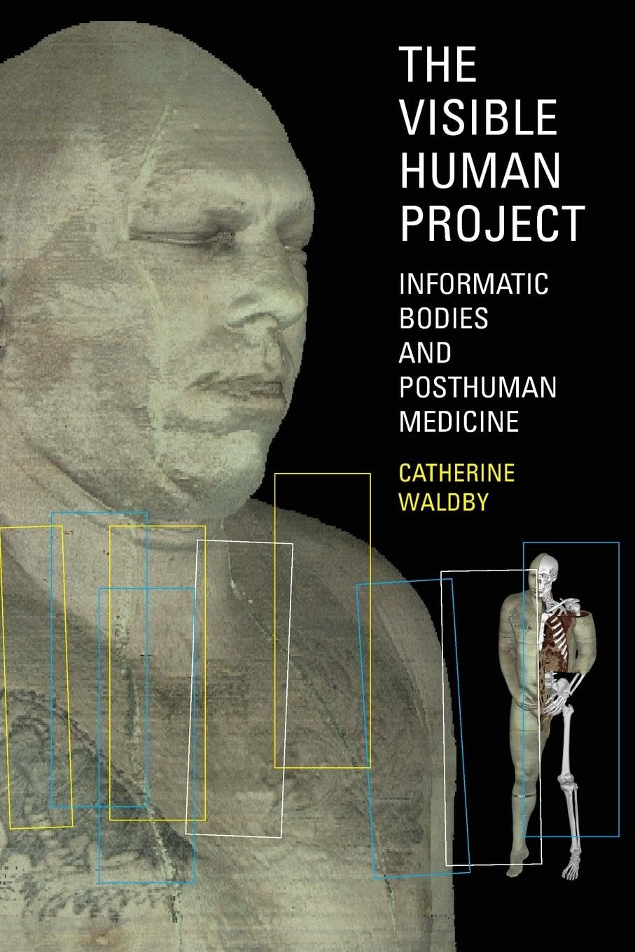 Visible Human Project Head NLMhead100.jpg